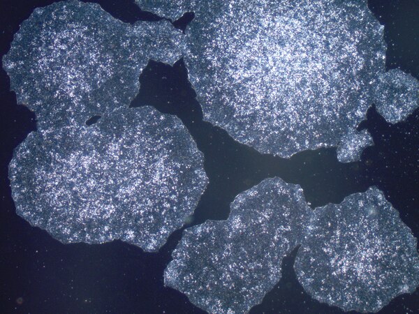 Simplicon® Human iPS Cell Line | SCC271